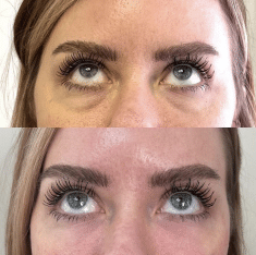 Before & After MedSpa Treatment Gallery | Stay Sculpted