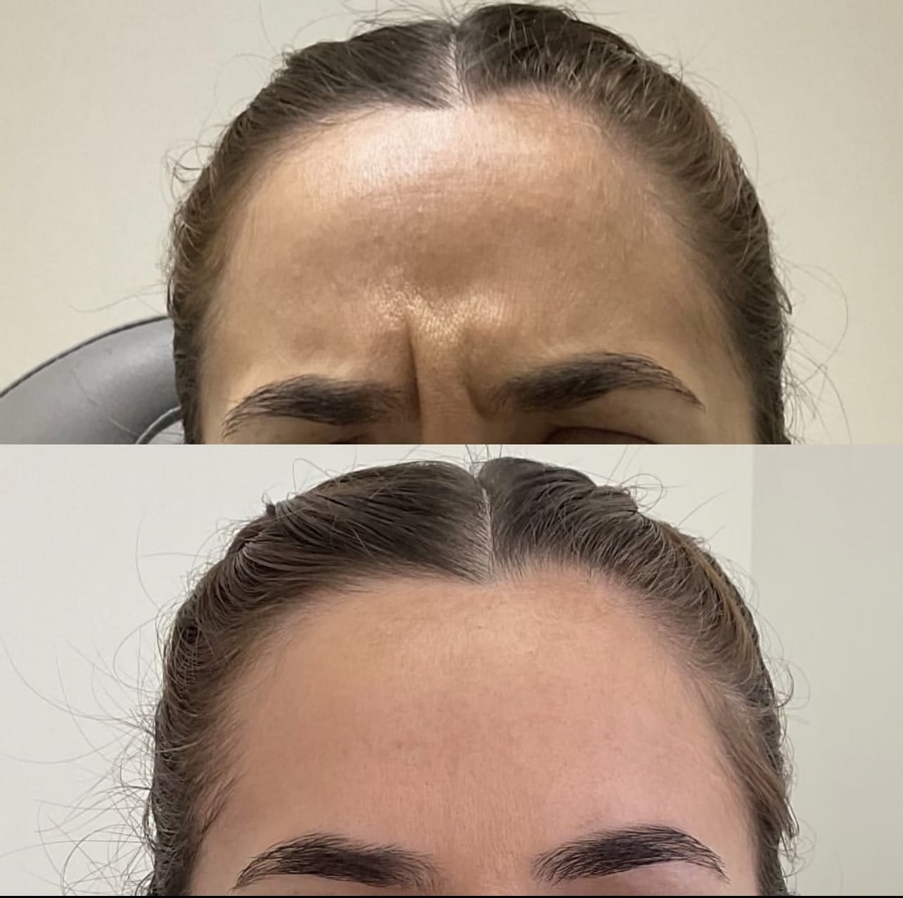 Before & After MedSpa Treatment Gallery | Stay Sculpted
